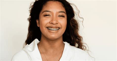 Pitts21 Braces Achieve Optimal Results Four Corners Orthodontics