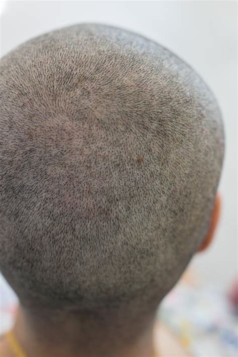Closeup Of Beautiful Shaved Head Big Babe Stock Photo Image Of Peace Fundraiser
