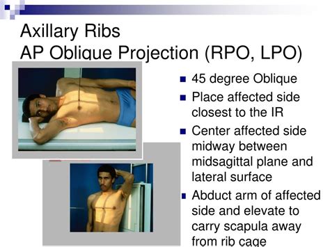 Ppt Bony Thorax Powerpoint Presentation Free Download Id6654164