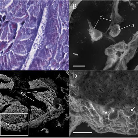 Micrographs Of Hemocytes In The Interstitial Tissues Of The