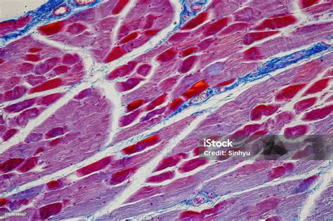 Mostrando La Micrografía Óptica Tipo De Tejido Humano Bajo El