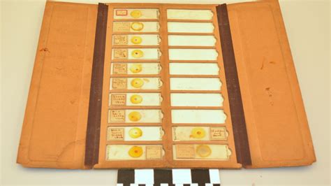 Jobs That Use Microscopes Applications Of Microscopes In Different