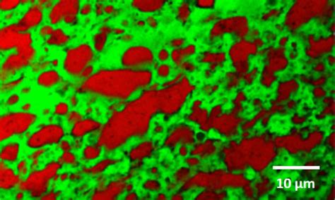 Microstructure