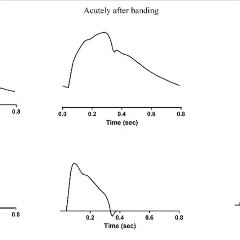 The Simulation Generated Aortic Pressure And Flow Waves For The Three