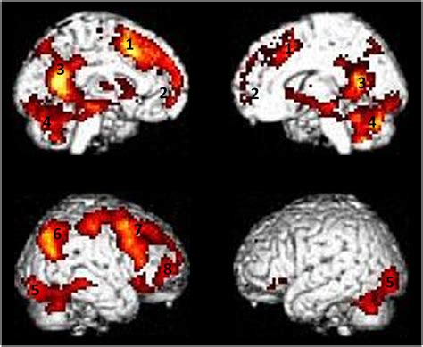 areas showing activity during retrieval of episodic autobiographical
