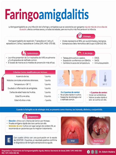 Faringoamigdalitis Pdf