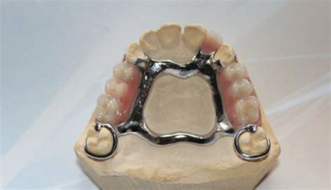 Dentures Coxhoe Dental