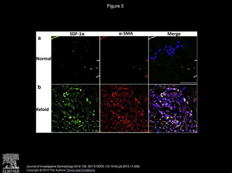 Tslp Is A Potential Initiator Of Collagen Synthesis And An Activator Of