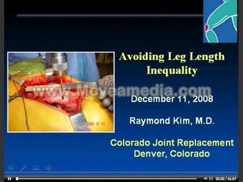 Avoiding Leg Length Inequality In Tha Orthogate