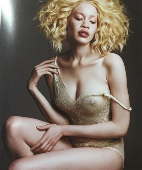 Albino Ebony Beauty Diandre Forrest Pic