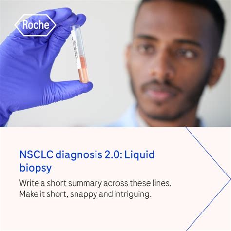 Nsclc Diagnosis 20 A Strategic View Of Liquid Biopsy Lableaders