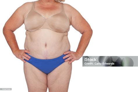 성형 술 판 절제술 Abdominoplasty 및 미 라 화장 후 체중 증가와 갱년기 여성 전체 바디 전면 보기 엉덩이에 손을 오른쪽 복사 공간 화장 영감 퇴색 된 흉터