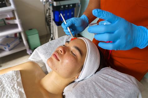 여드름 치료를 위해 젊은 여자의 이마에 화학 껍질을 적용하는 미용사 20 24세에 대한 스톡 사진 및 기타 이미지 20 24세 20 29세 2명 Istock