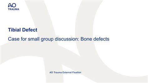 Tibia Defect Transportation Nail Oct52018 Pptx