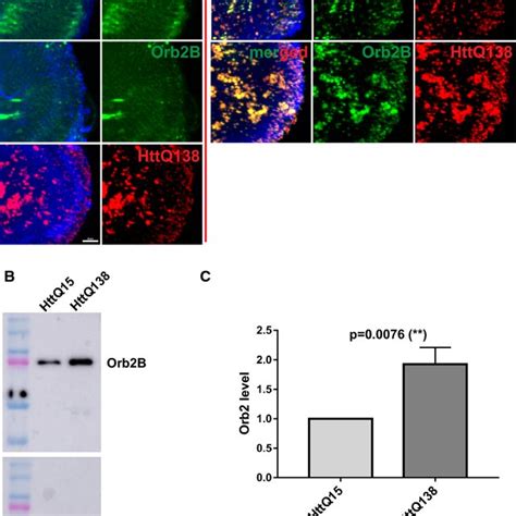 A Puromycin Incorporation Assay Was Performed Using Anti Puromycin
