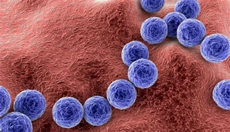 Streptococcus Pyogenes Una Bacteria Peligrosa Diario Del Rey