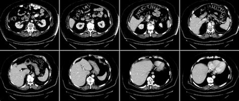 Modules — Monai 1 5 0 Documentation