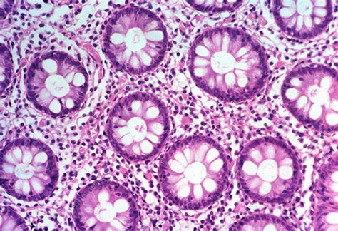 Crypt Of Lieberkuhn Stock Image C044 8592 Science Photo Library