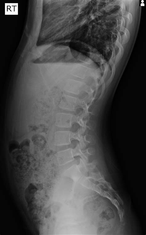La Semantic Segmentation Semantic Segmentation Dataset By Spine