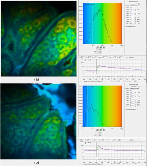 Mpm Of The Viable Epidermis Determining Fluorescence Lifetimes Of Download Scientific Diagram
