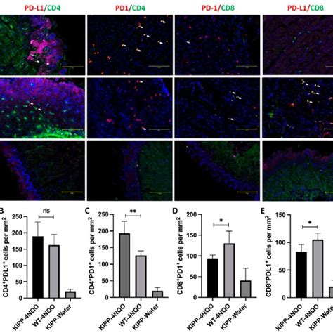 Differential Expression Of T Cell Immune Checkpoint Pd L1 And Pd 1 In