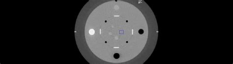 Ct Scanner Calibration The Core Of Ct Maintenance Amber Diagnostics