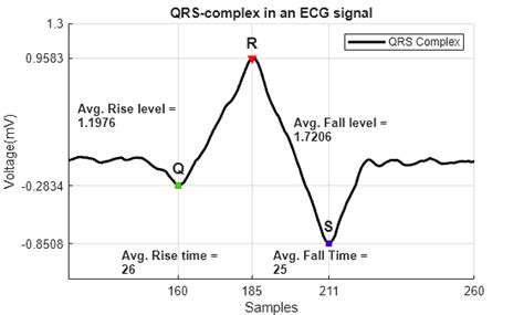 Descriptive Statistics MATLAB Simulink