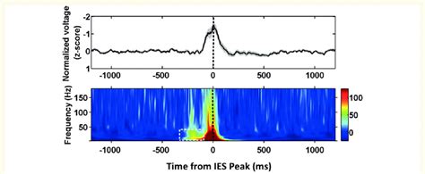 Spike Triggered Average During Correct Encoding Top Spike Centred