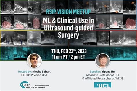 Rsip Vision On Linkedin Medicalimaging Ai Machinelearning Webinar