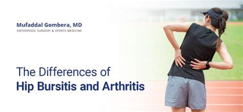 Severe Symptoms Of Hip Bursitis