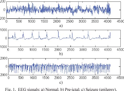Figure 1 From Automated Pre Ictal Phase Detection Algorithm From Eeg