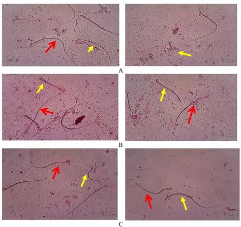 Sperm Morphology Of Groups III IV And V Or Treatment Groups 1 2 And 3 Download Scientific