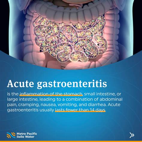 Acute Gastroenteritis Age Metro Pacific Iloilo Water