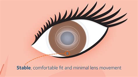 optimized lens geometry™ coopervision