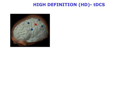 Ppt A System And Device For Focal Tdcs Highdefinitionhd Tdcs