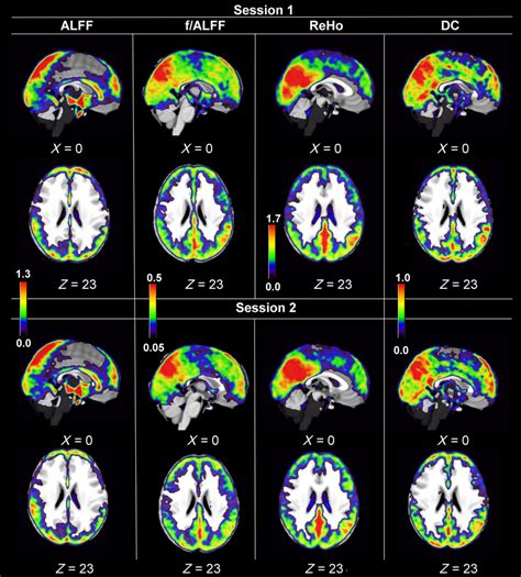 Depiction Of The Average Of Each Functional Magnetic Resonance Imaging