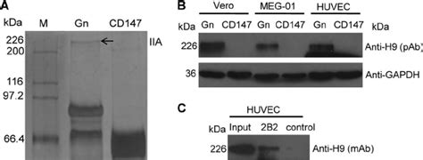 Interaction Of Nmmhc Iia With Sftsv Glycoprotein Gn A Vero Cells Download Scientific Diagram