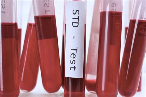 Chlamydia In Bali What You Need To Know Unicare Clinic