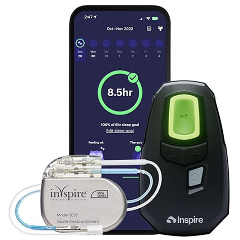 Inspire Sleep Apnea Innovation Obstructive Sleep Apnea Treatment