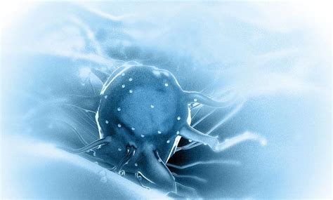 肿瘤的高危人群，有你吗？ 知乎