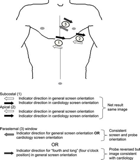 Scanning School Cardiac — Taming The Sru