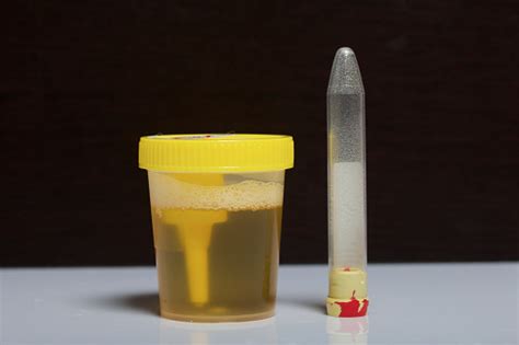 분석을 위해 용기에 소변 나사 캡이 있는 진공 테스트 튜브용 내장 홀더가 있는 일회용 의료 폴리머 멸균 용기 0명에 대한 스톡