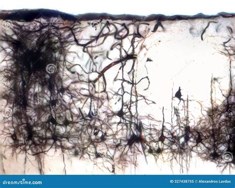 Golgi Stain Brain Stock Image Image Of Microscope 327438755