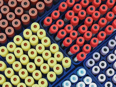 Hematocrit Test What It Is Levels High And Low Range