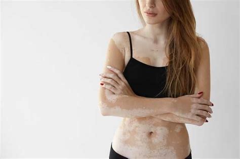 Can Gabapentin Cause A Rash