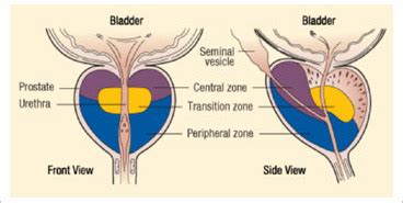 RADIOLOGY Review Prostate