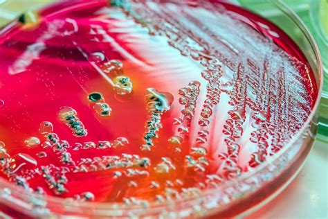 Pseudomonas Skin Infection Causes Symptoms Treatment And Prevention Sergio Mazzei