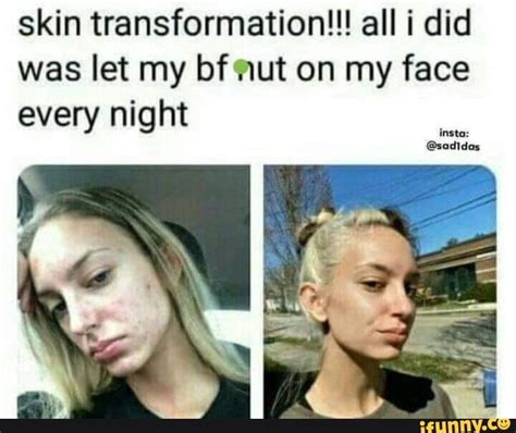Skin Transformation All I Did Was Let My Bf Ut On My Face Insta