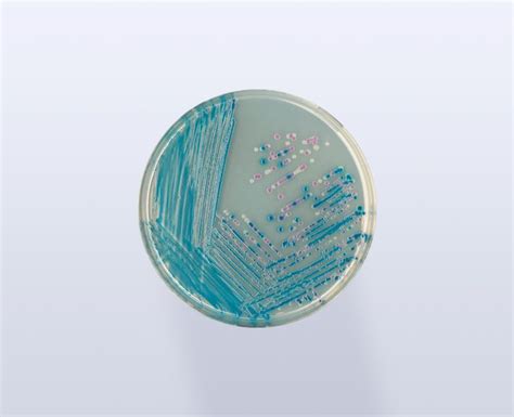 Chromagar™ Stec Plastlabor