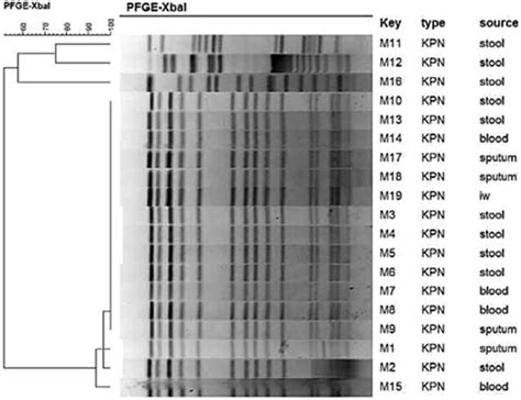 Dendrogram Of Pfge Patterns Of Chromosomal Dna Restriction Fragments